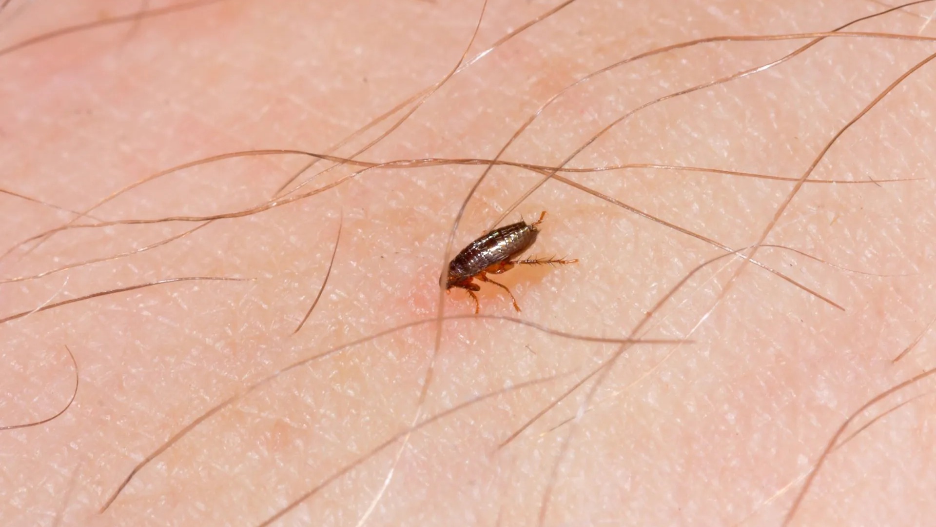 Can Dog Fleas Live in Human Hair ? Facts You Should Know | BC Pest Control